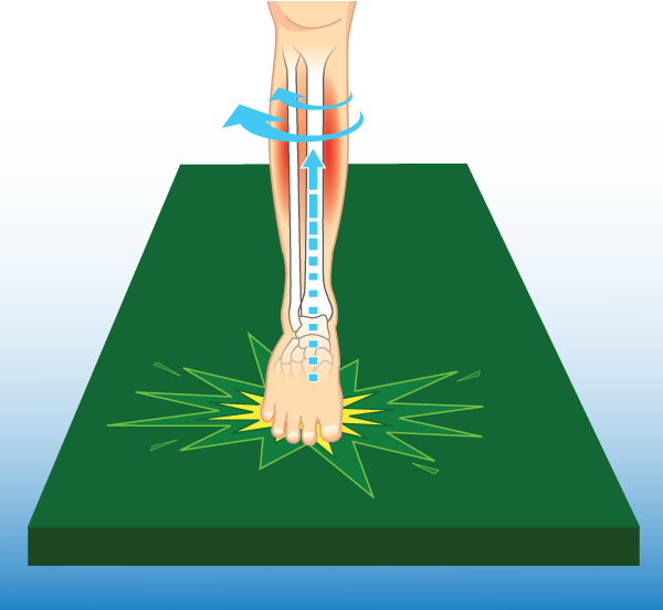 What we can learn about bones from Olympic gymnast’s gruesome injury ...