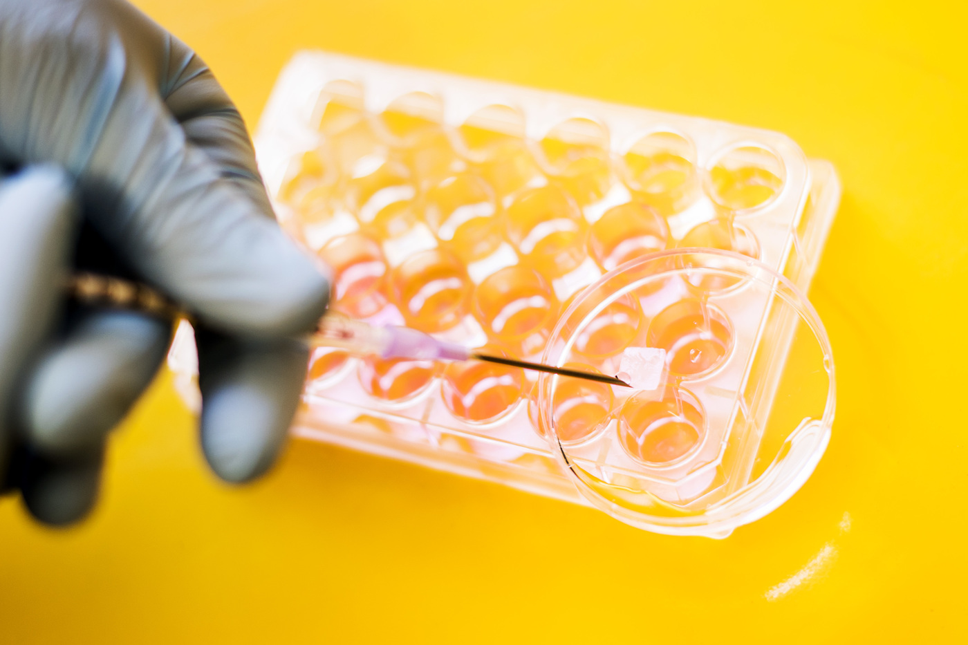 These Sponge-Like Gels Can Help Grow New Tissue