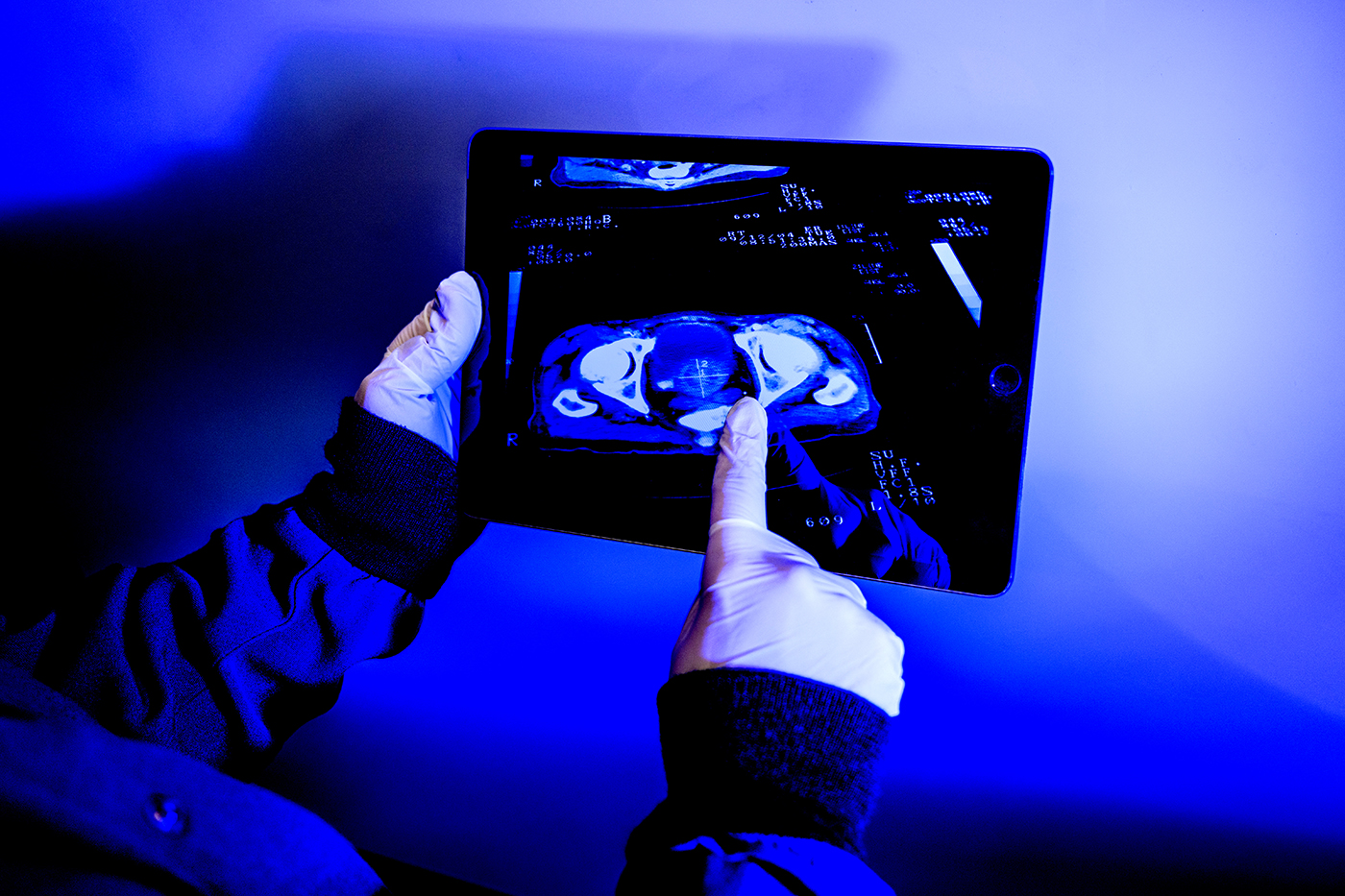 Ai Enhanced Web Tool Can Speed Up Prostate Cancer Detection