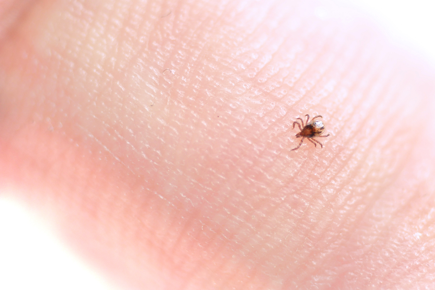 5 Summer Safety Tips for Preventing Tick Bites