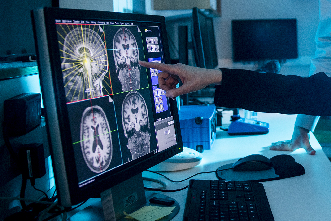 Northeastern’s NeuroPRISM Tools Map Brain with Precision