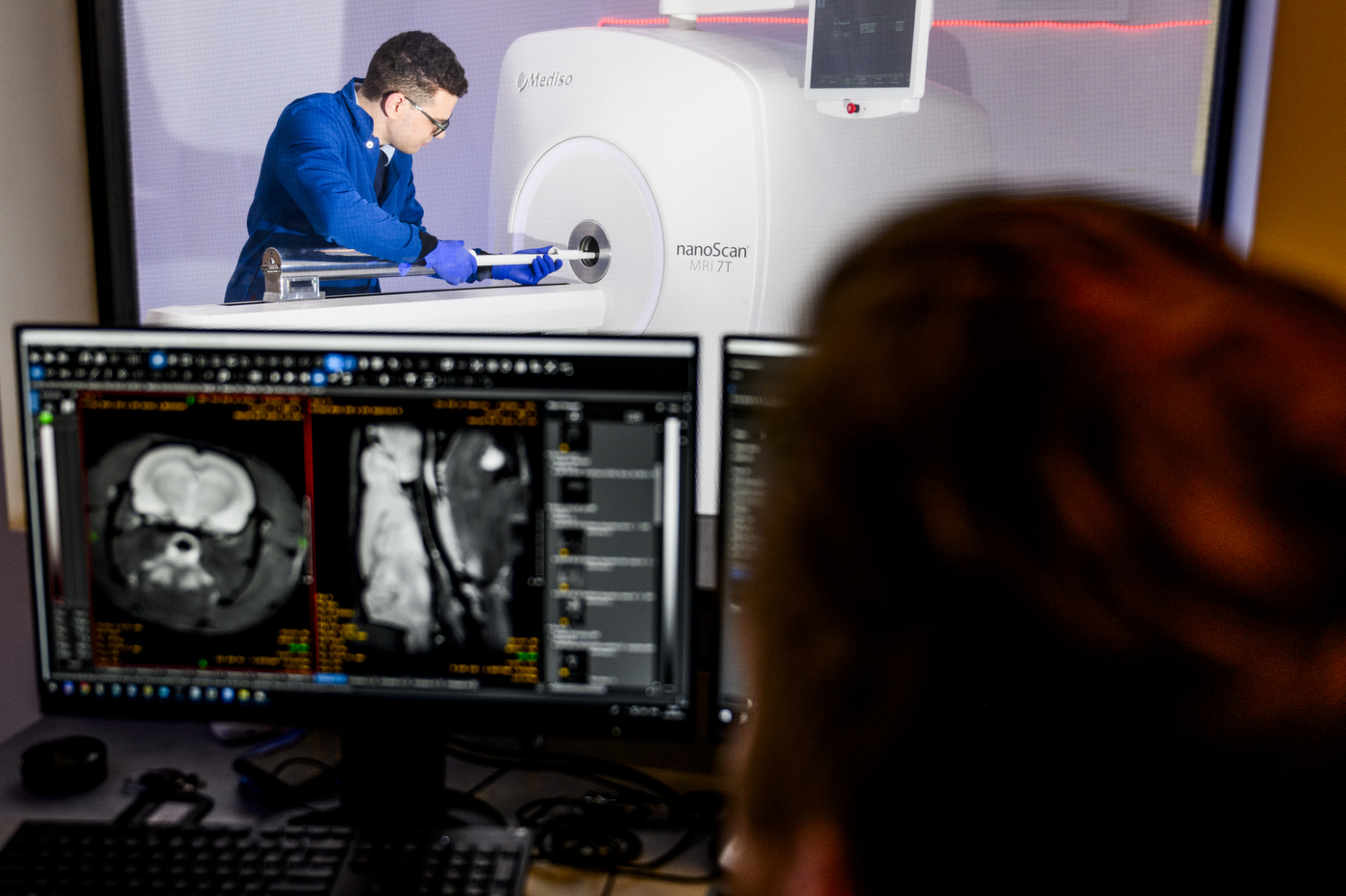 Northeastern Gets First-of-Its-Kind Brain Scanner