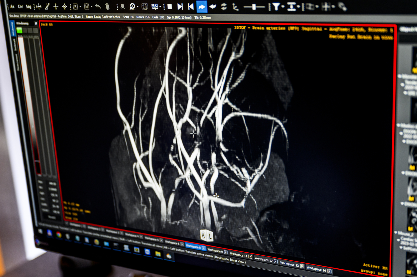 Northeastern Gets First-of-Its-Kind Brain Scanner