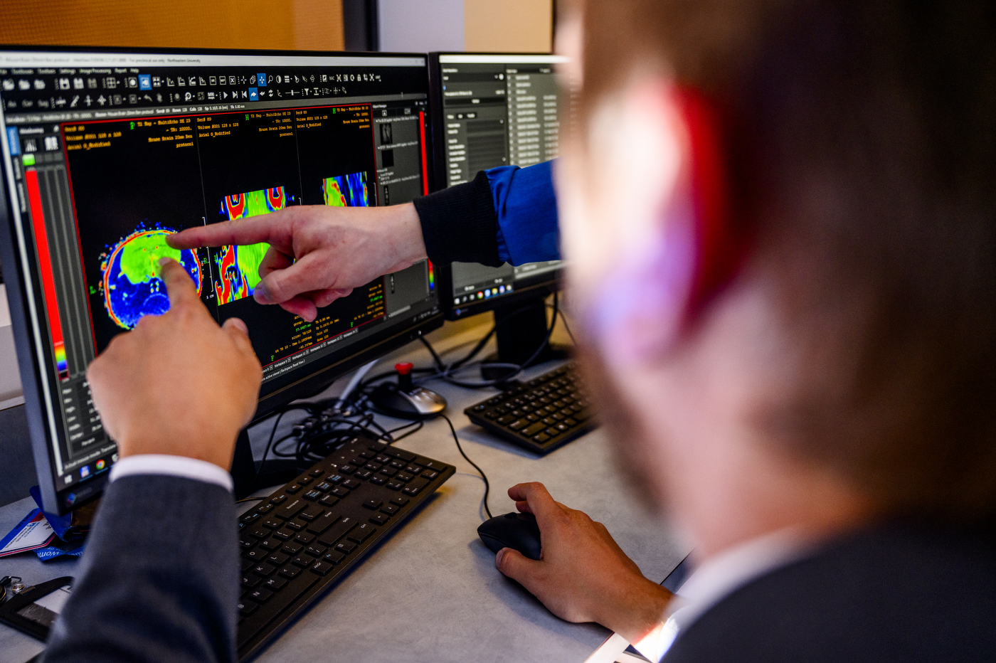 Northeastern Gets First-of-Its-Kind Brain Scanner