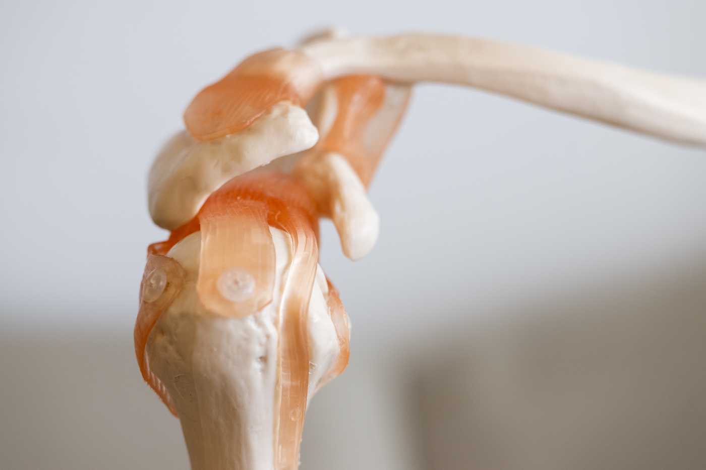 How Experts Explain and Treat Rotator Cuff Pain